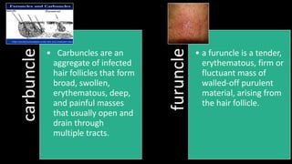 BACTERIAL SKIN INFECTION.pptx