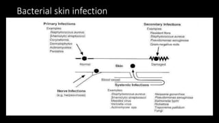 BACTERIAL SKIN INFECTION.pptx