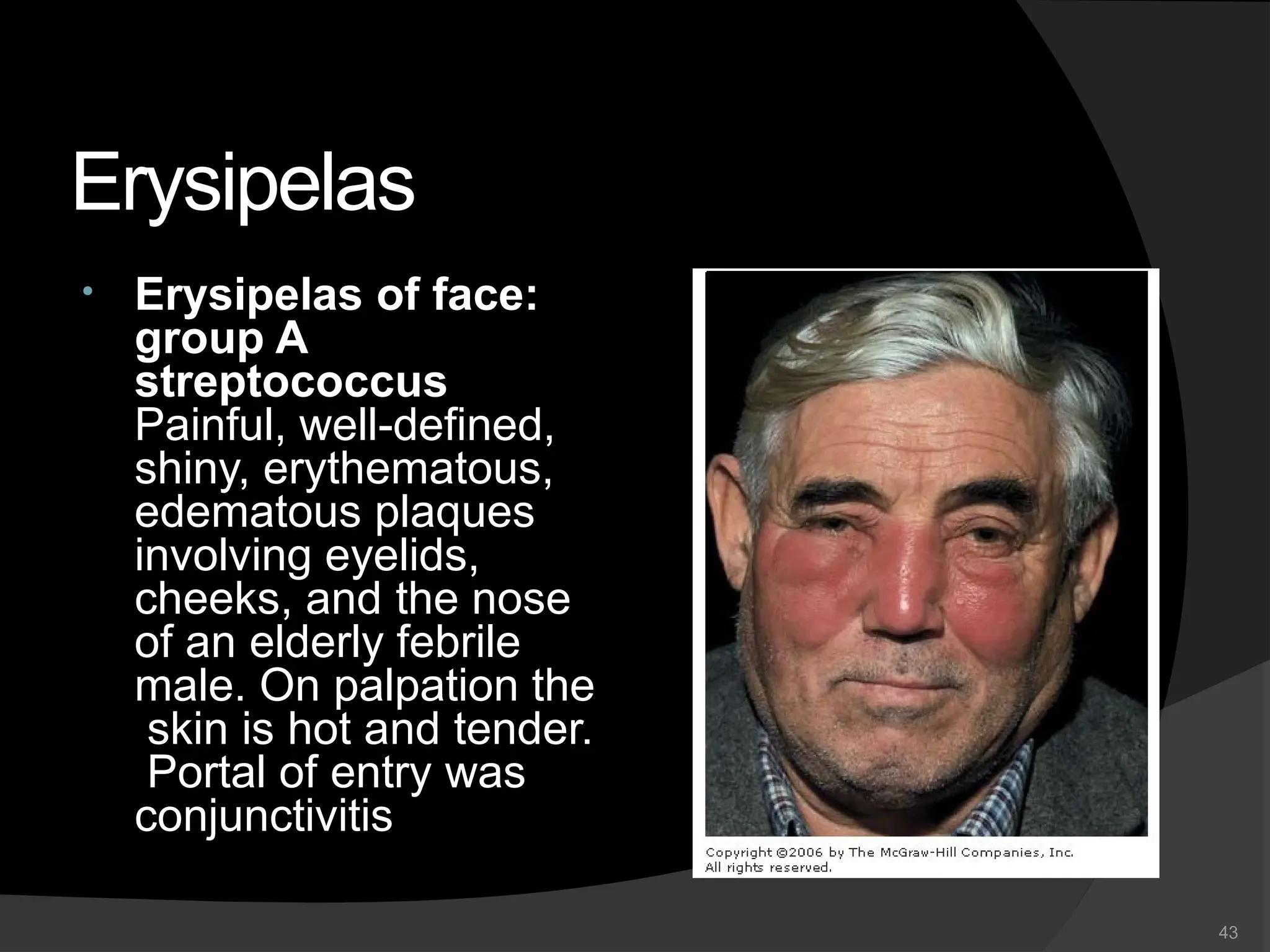 bacterial skin infections class.pptx Detailed | PPT | Free Download