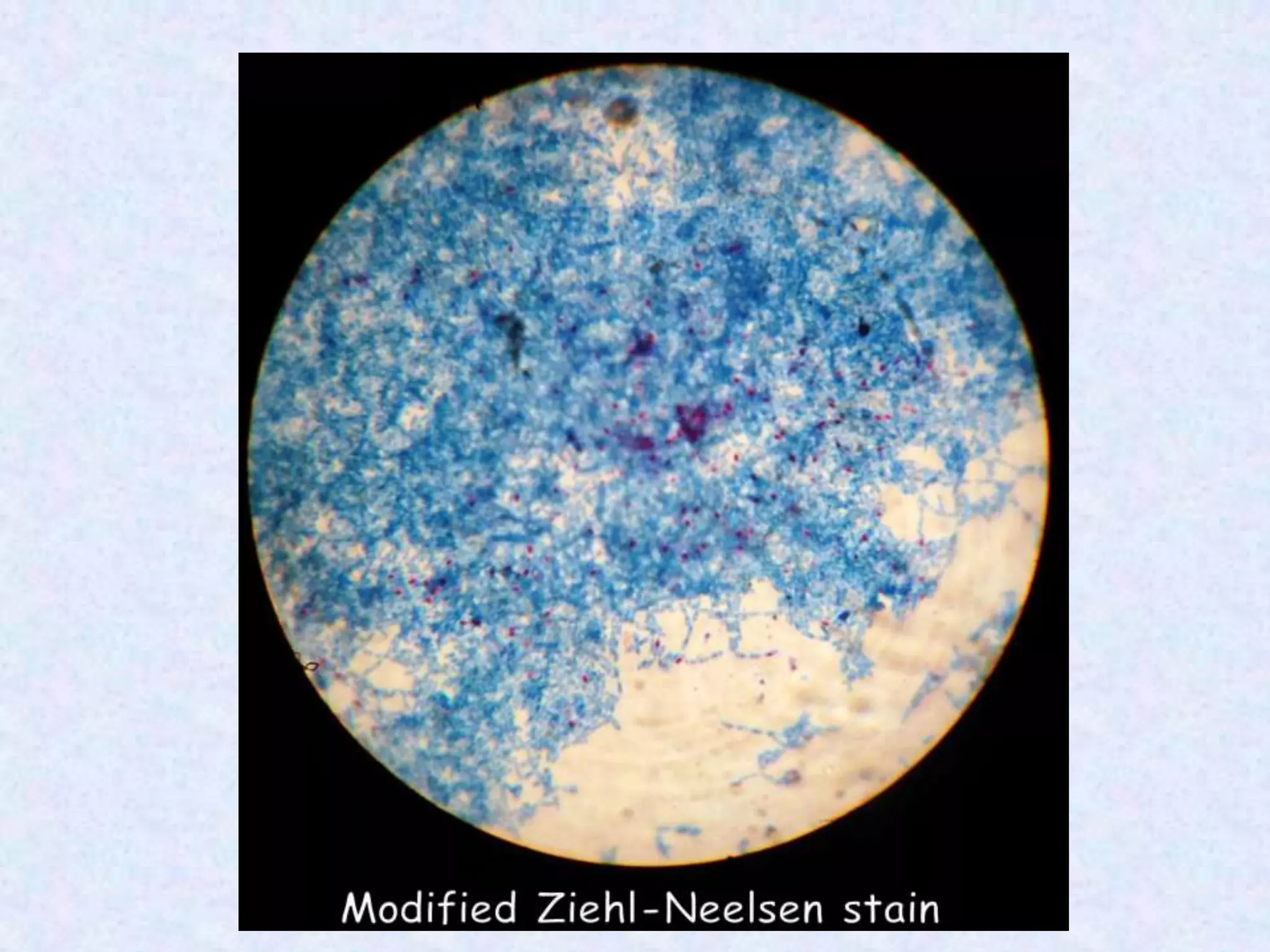 bacterial spore.ppt