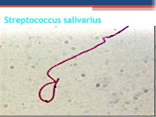 Streptococcus Salivarius Capsule Stain