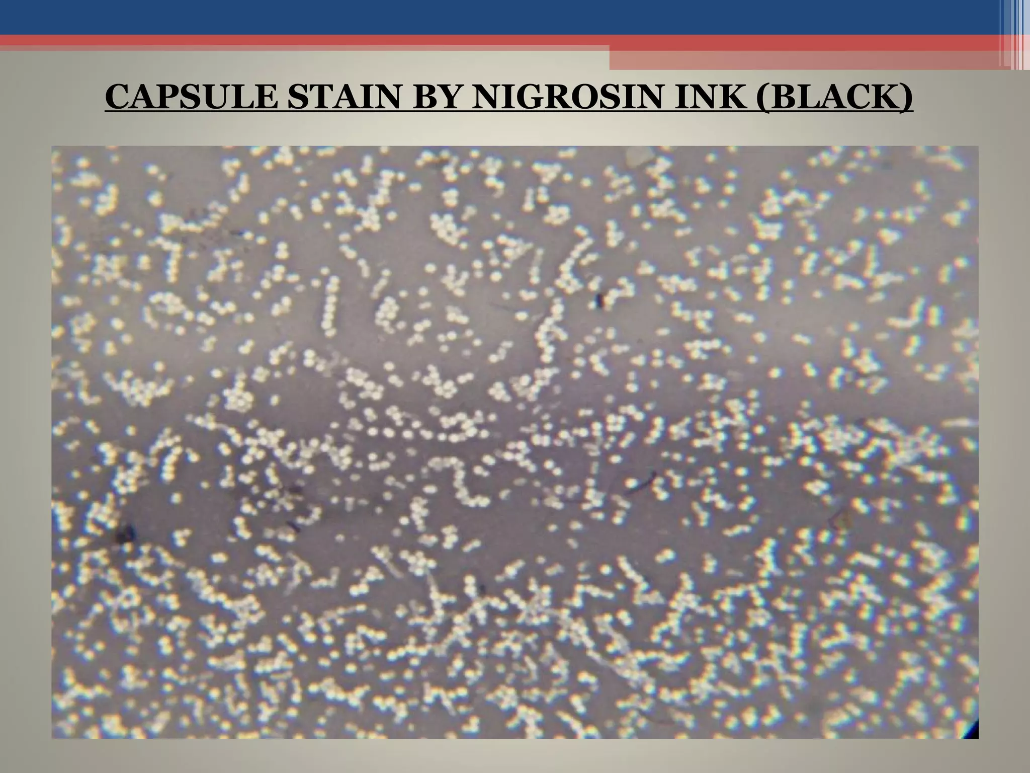 Bacterial staining | PPT