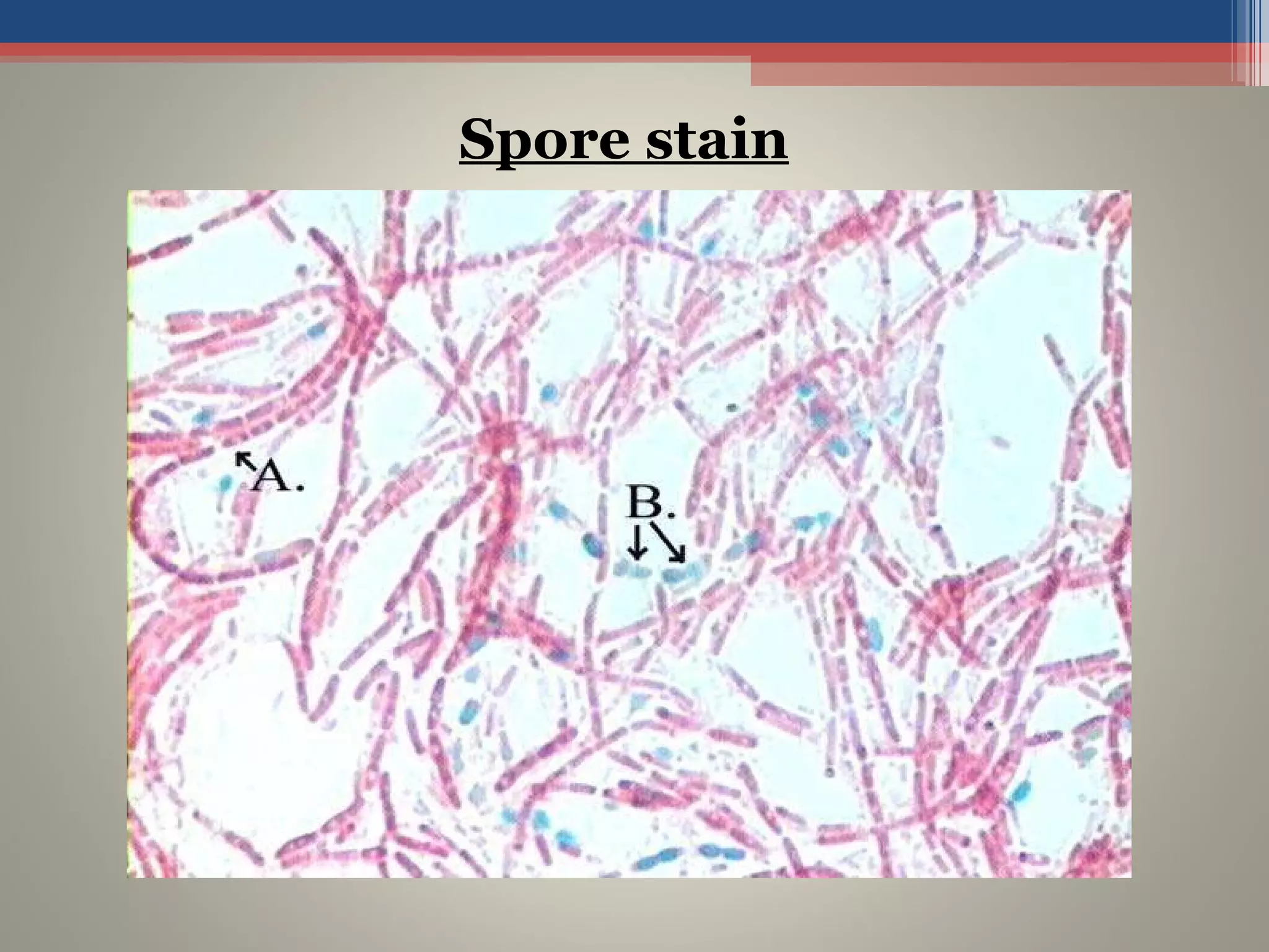 Bacterial staining | PPT