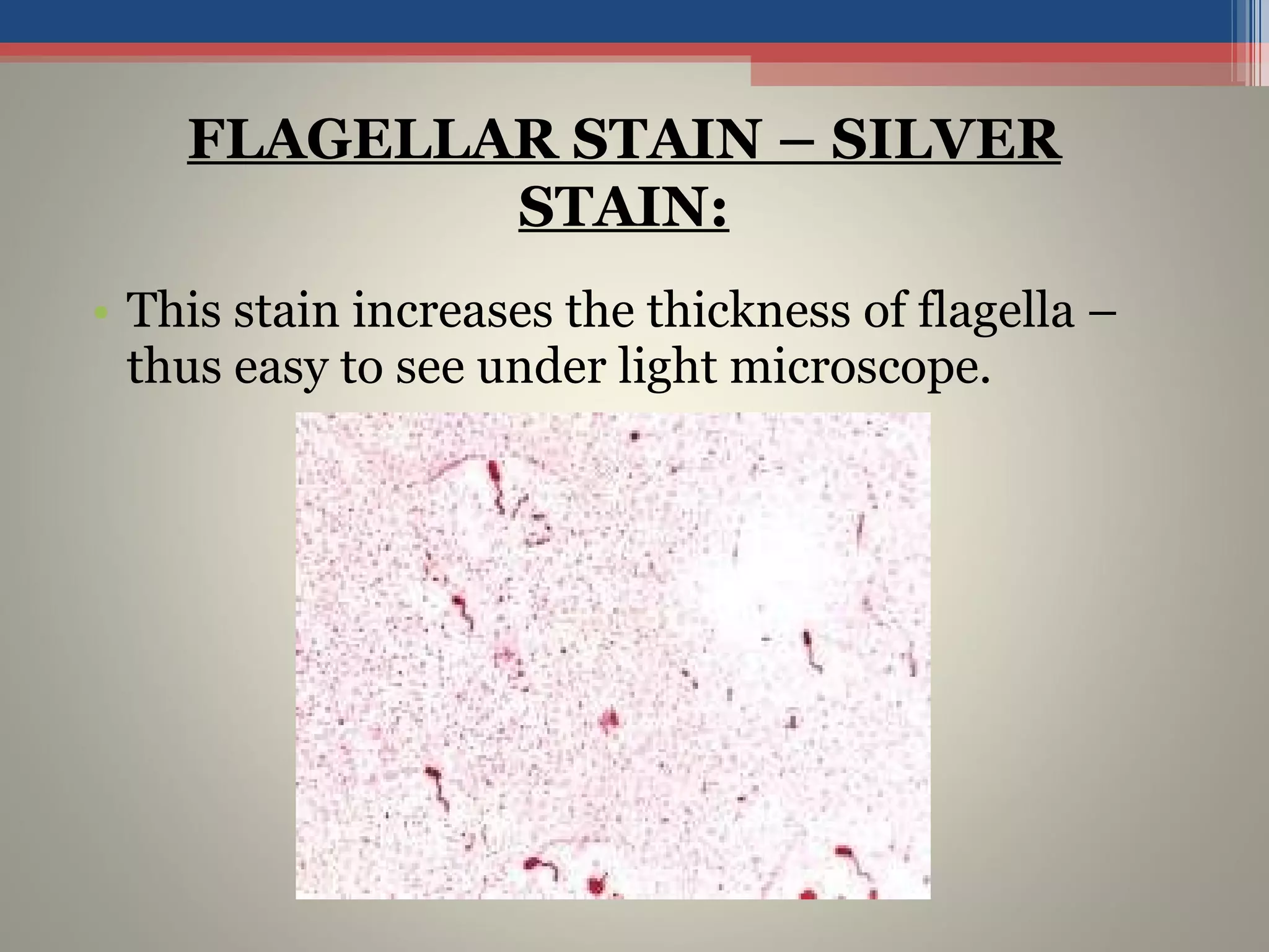 Bacterial staining | PPT