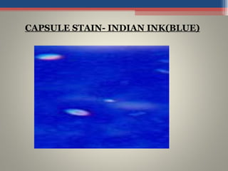 Bacterial staining | PPT