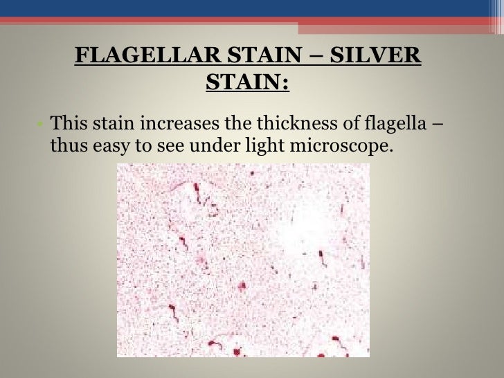 Flagella Stain Procedure