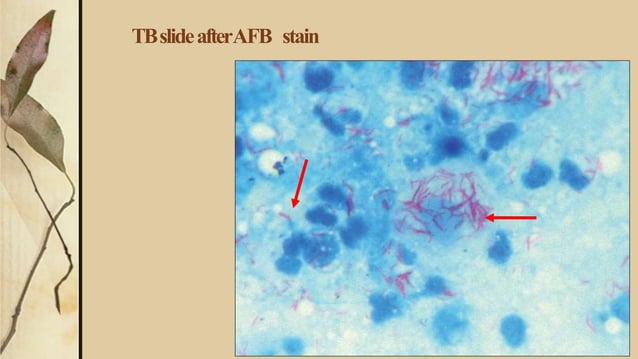 bacterial staining.pptx