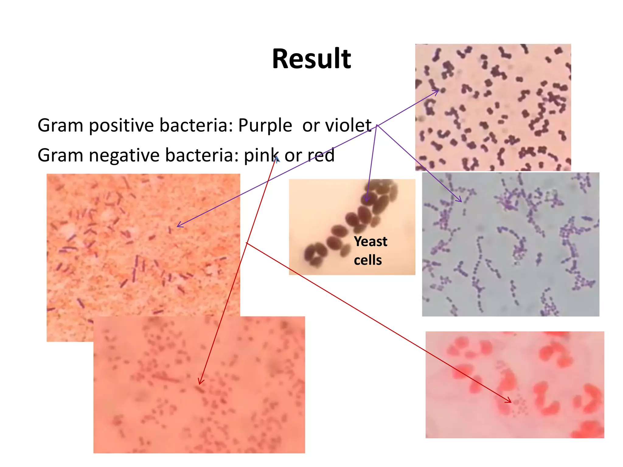 Bacterial staining methods | PPT