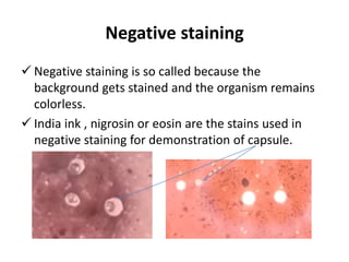 Bacterial staining methods | PPT