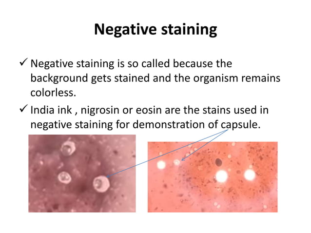 Bacterial staining methods | PPT