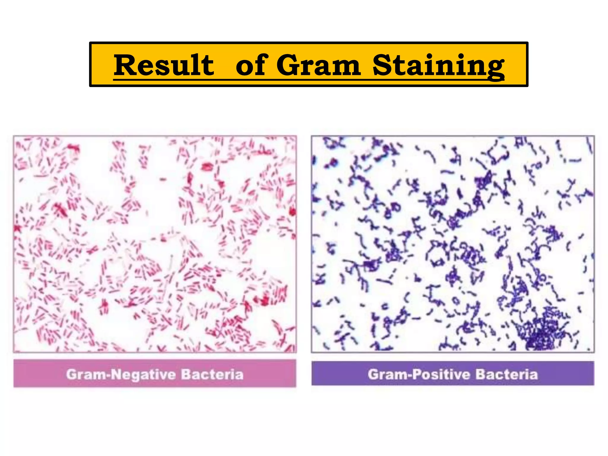 Bacterial Staining Techniques | PPTX