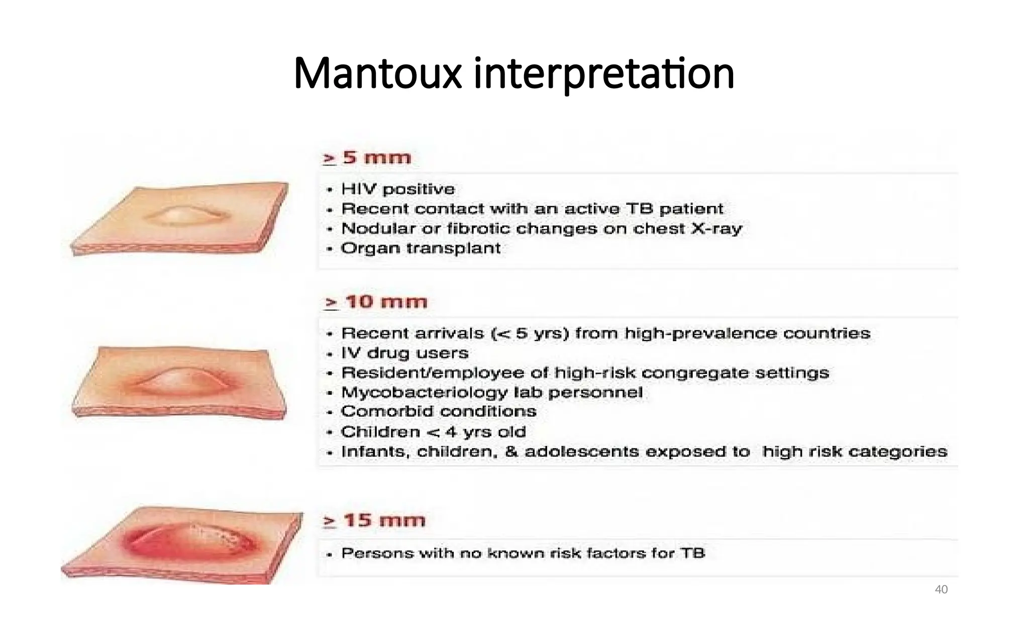 Bacterial uveitis (Tuberculosis - Anterior- Posterior manifestation) | PPTX