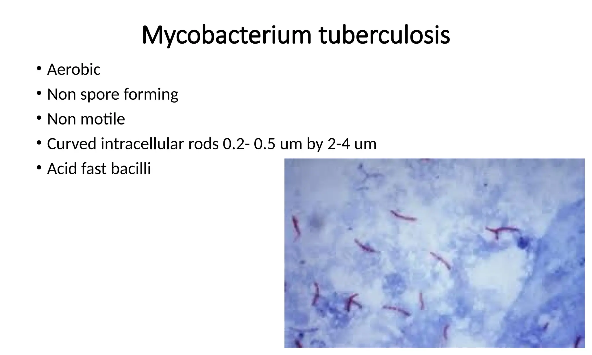 Bacterial uveitis (Tuberculosis - Anterior- Posterior manifestation) | PPTX
