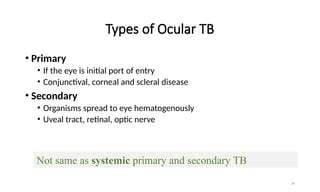 Bacterial uveitis (Tuberculosis - Anterior- Posterior manifestation) | PPTX