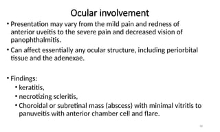 Bacterial uveitis (Tuberculosis - Anterior- Posterior manifestation) | PPTX