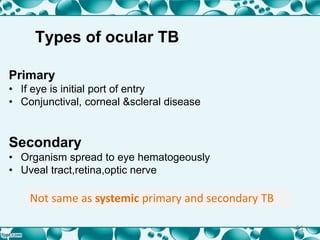 Bacterial uveitis | PPTX