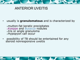 Bacterial uveitis | PPTX