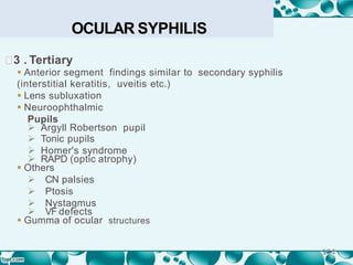 Bacterial uveitis | PPTX