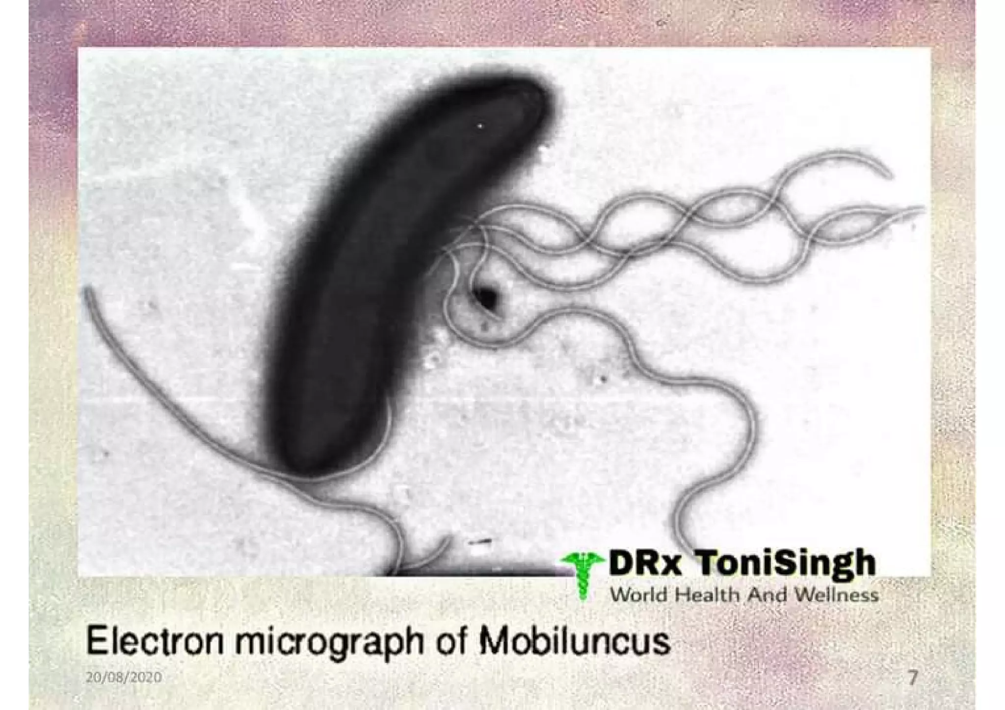Sureswab Adv Bacterial Vaginosis Bv Tma - Moovari