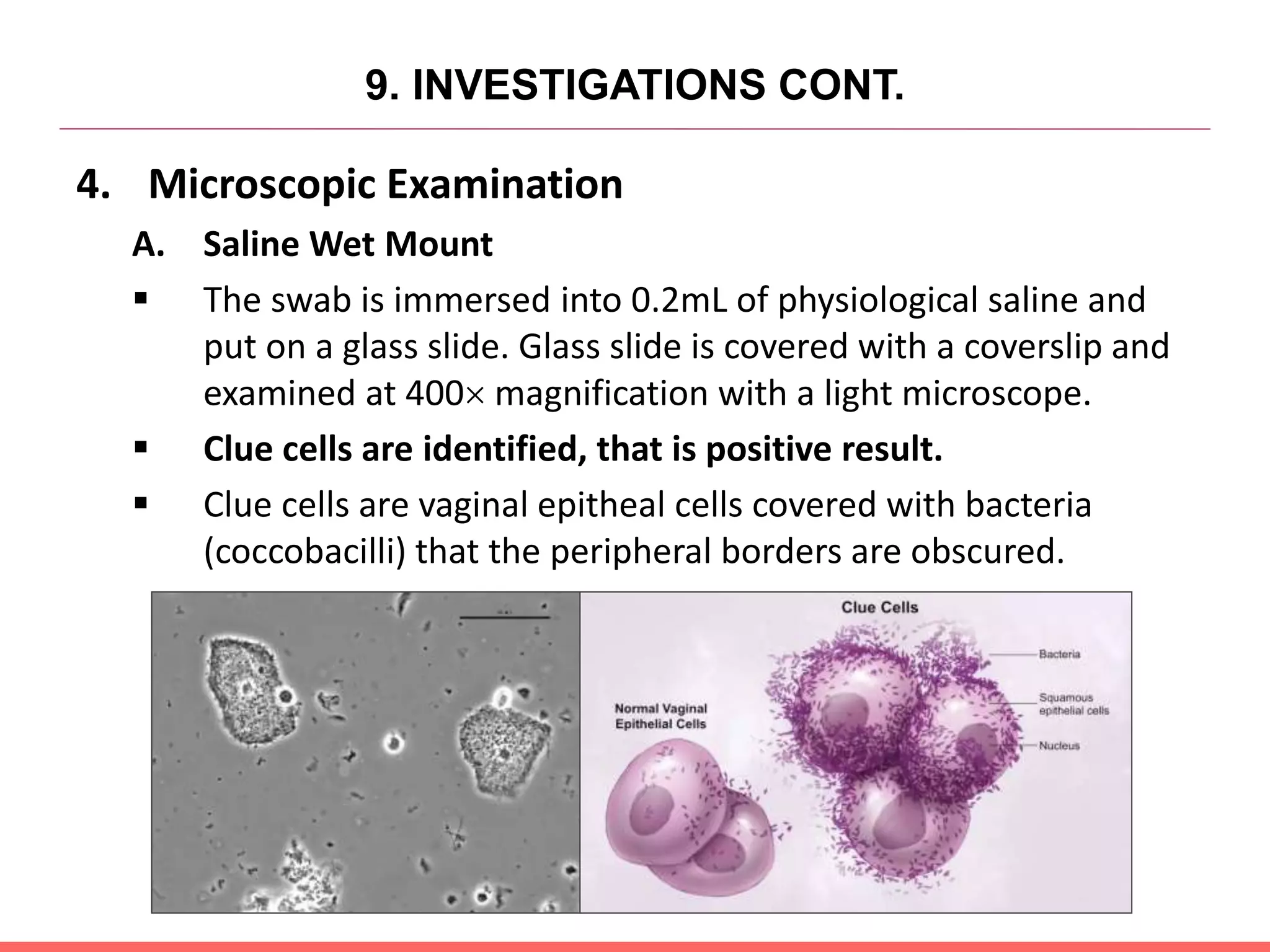Bacterial Vaginosis.pptx