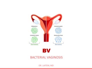 Bacterial Vaginosis.pptx