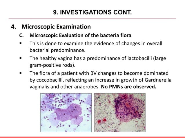 Bacterial Vaginosis.pptx | Sexual Conditions | Sexual Health