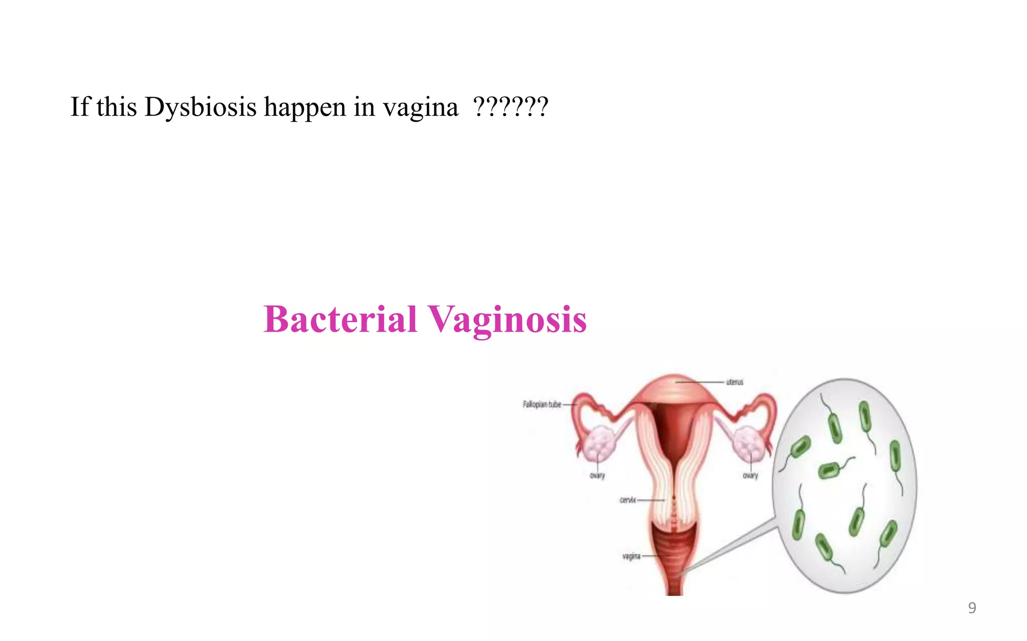 BACTERIAL VAGINOSIS -BV.pptx