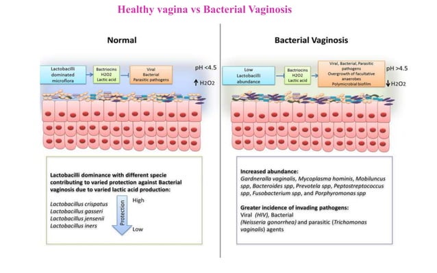 BACTERIAL VAGINOSIS -BV.pptx