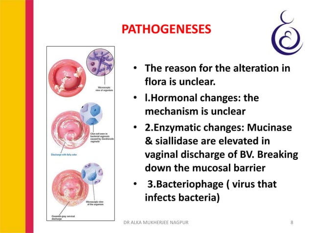 Bacterial vaginosis by dr alka mukherjee DR APURVA MUKHERJEE nagpur m.s ...