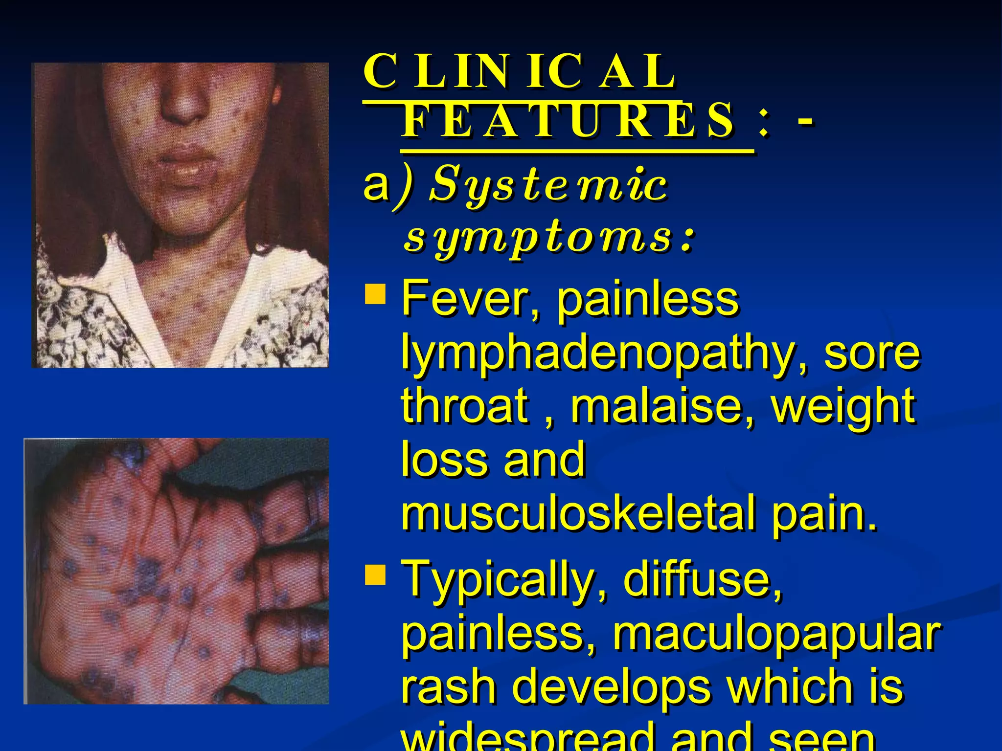 Bacterial, Viral & Mycotic Infections | PPT