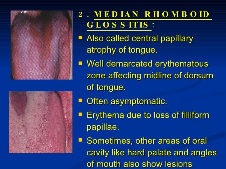 Bacterial, Viral & Mycotic Infections