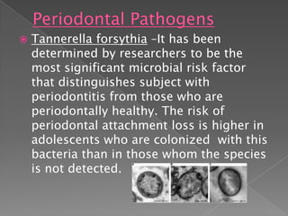 Bacteria of periodontits Powerpoint Presentation | PPTX