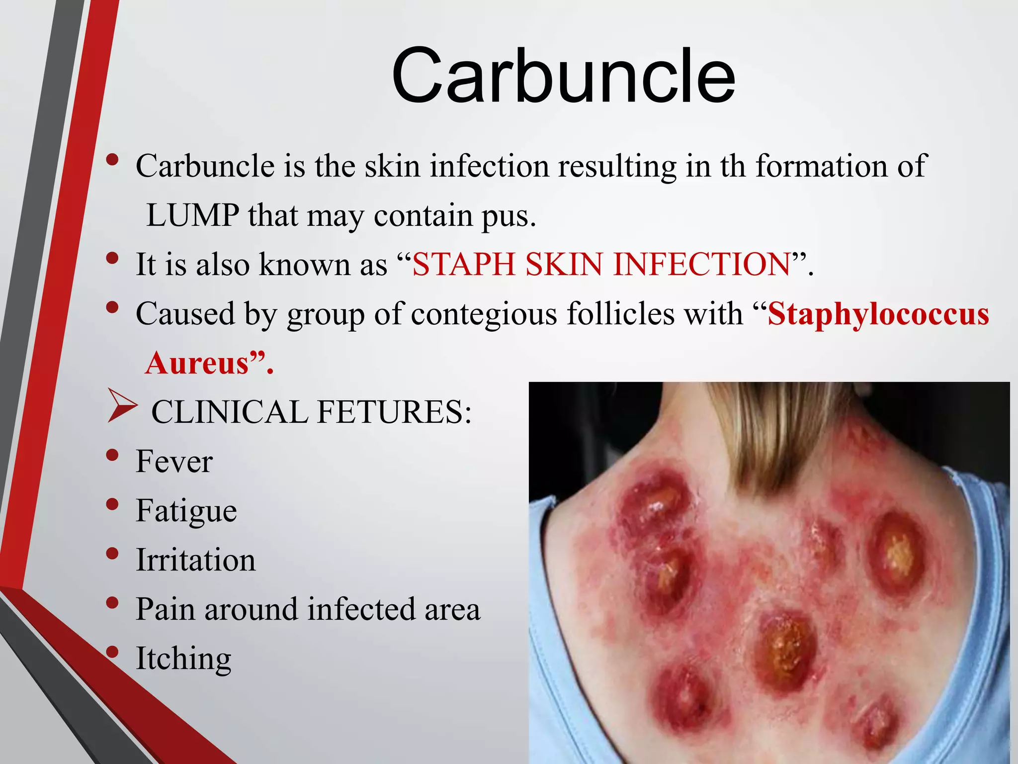 Introduction to Bacteria .. | PPTX