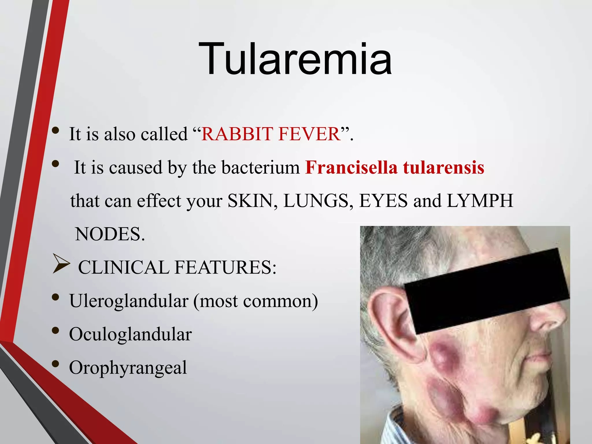 Introduction to Bacteria .. | PPTX