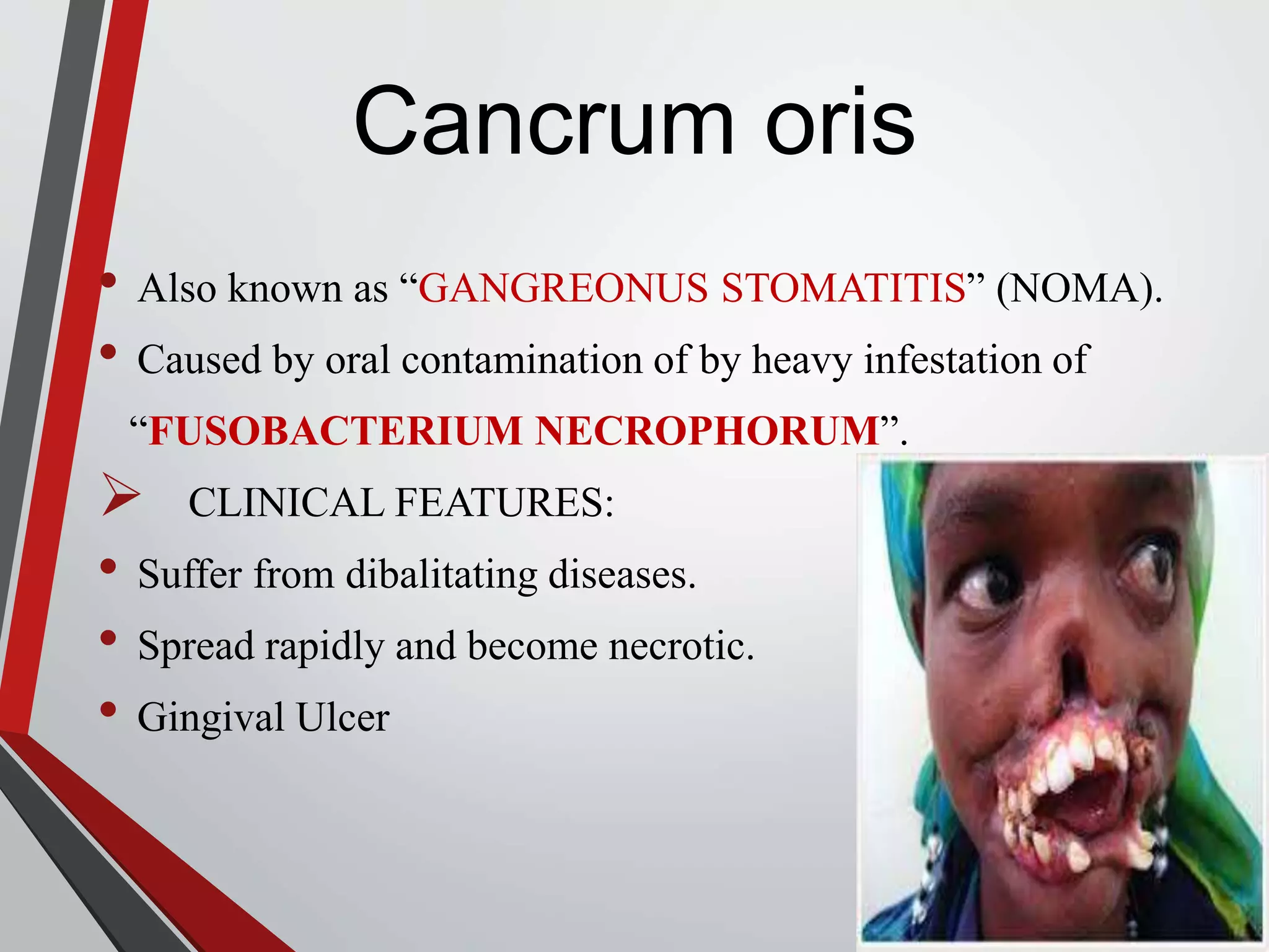 Introduction to Bacteria .. | PPTX