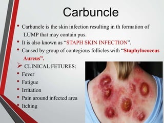 Introduction to Bacteria .. | PPT