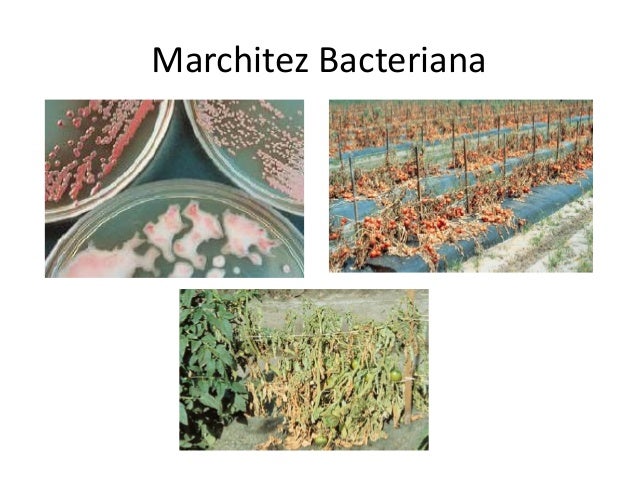 Bacterias