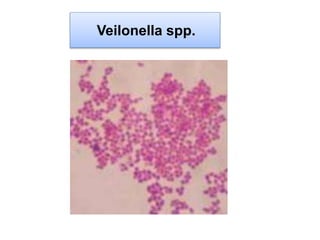 Bacterias gramnegativas anaerobias.pptx