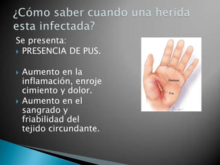 Heridas e Infección - Generalidades | PPTX