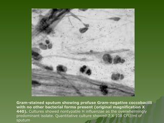 NEUMONIA CAUSADA POR S. pneumoniae, H. influenzae - BACTERIOLOGIA | PPT