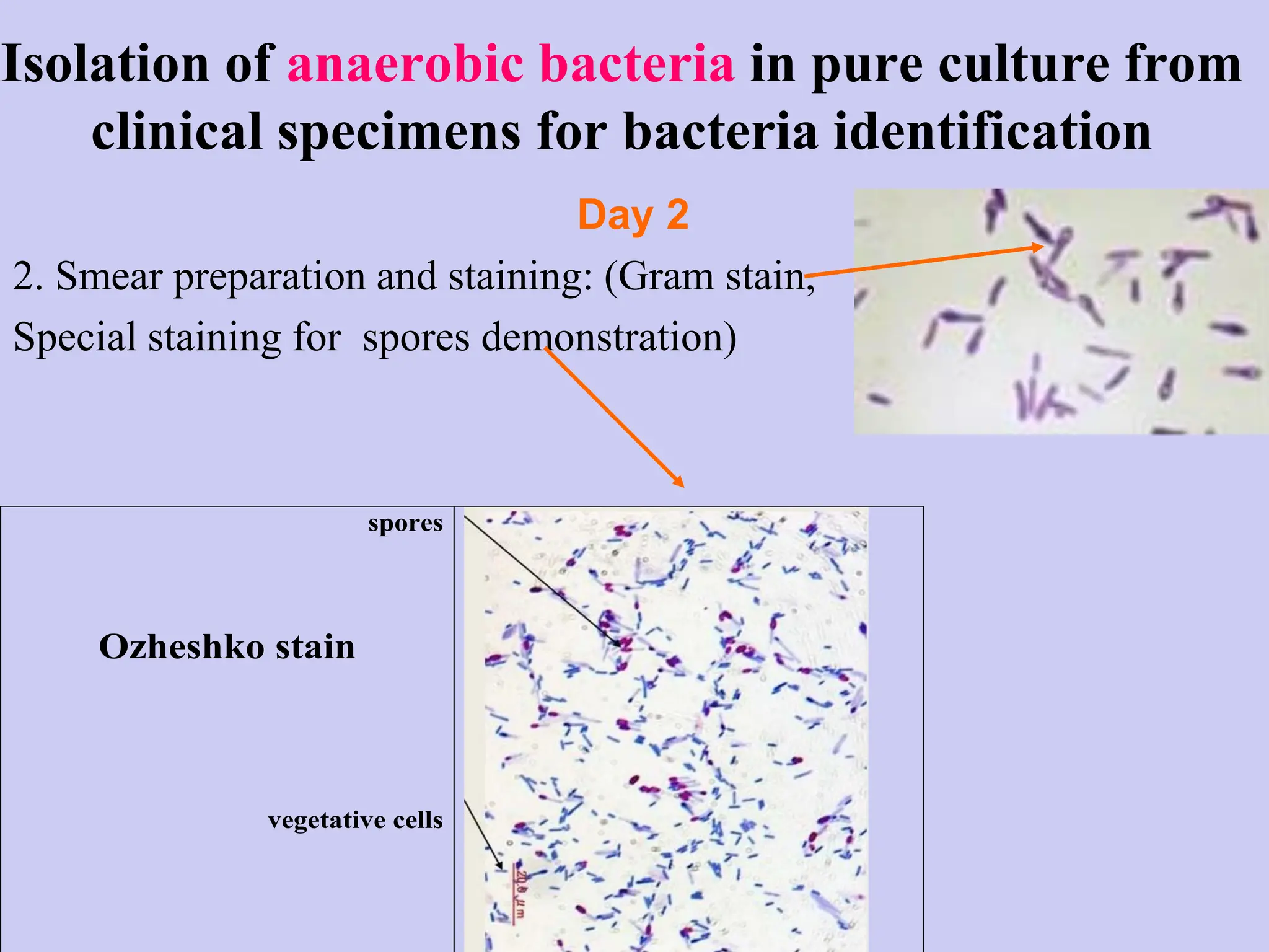 Bacteriological method — Anaerobic bacteria.pdf