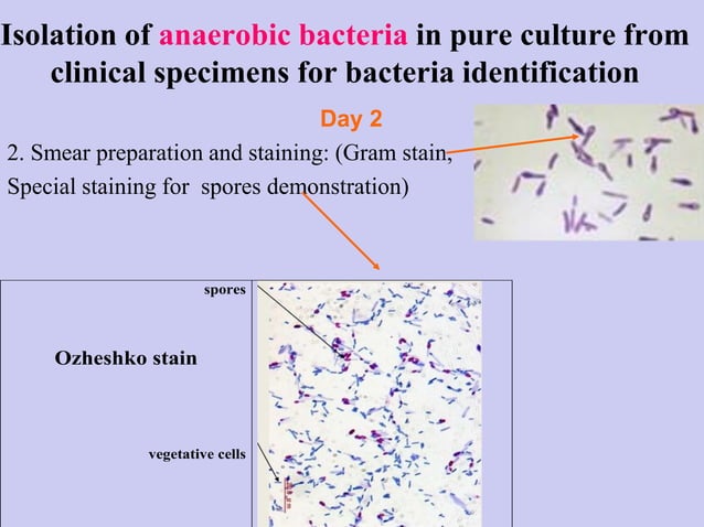 Bacteriological method — Anaerobic bacteria.pdf