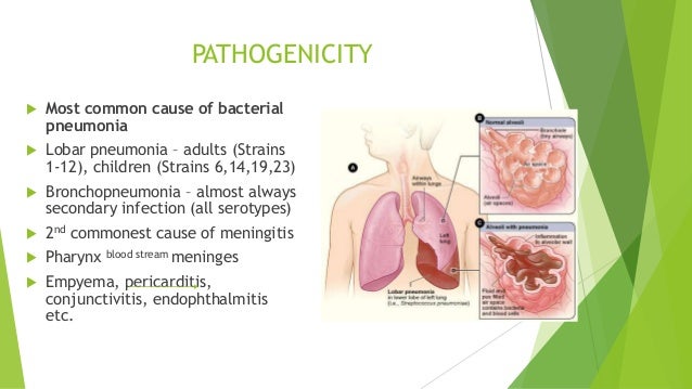 Bacteria causing Endophthalmitis