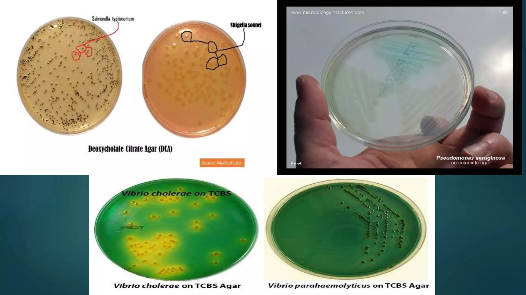Bacteriology (application of basal and differential media)- Naresh velu ...