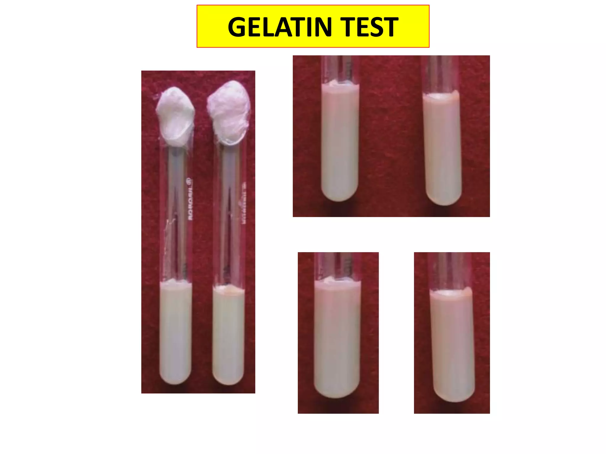 BACTERIOLOGY PRACTICALS PPT.pptx