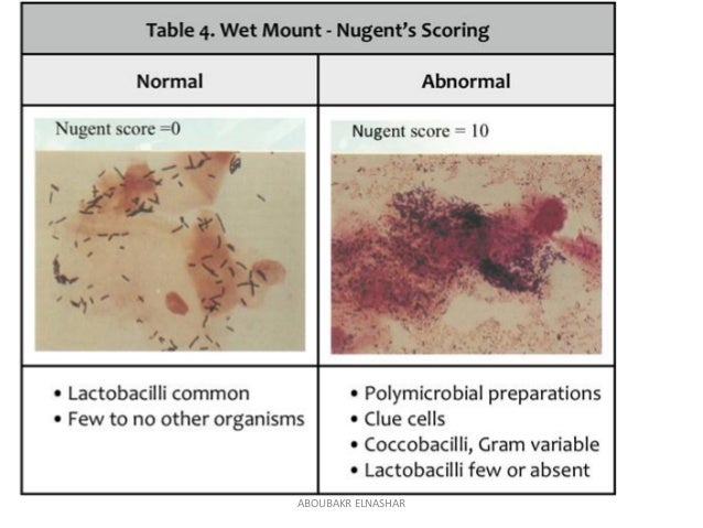 Bacterial vaginosis diagnosis