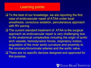 TEVAR for ATAA with Minimalist Approach | PPT