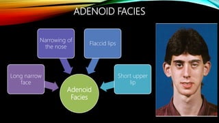 Bad oral habits | PPTX