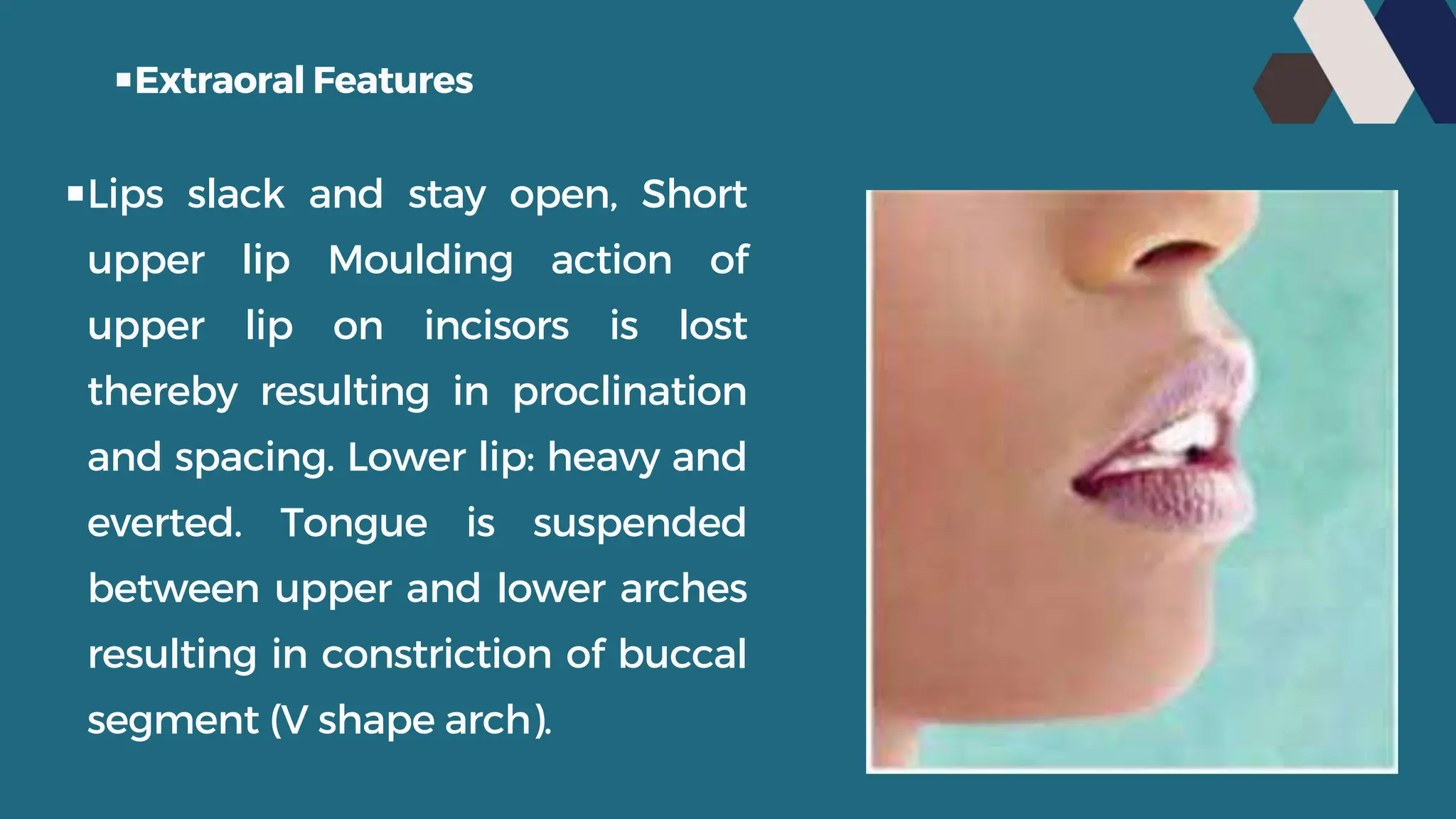 Bad oral habits in orthodontic..... pptx | PPTX