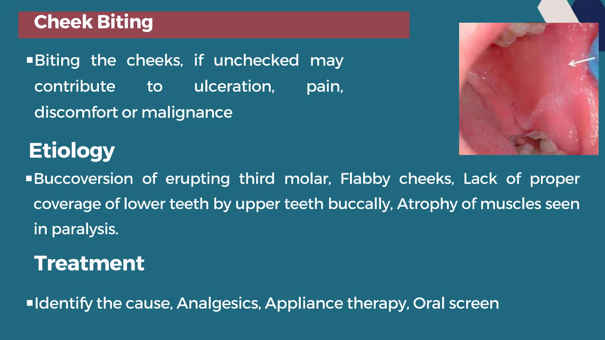 Bad oral habits in orthodontic..... pptx | PPTX